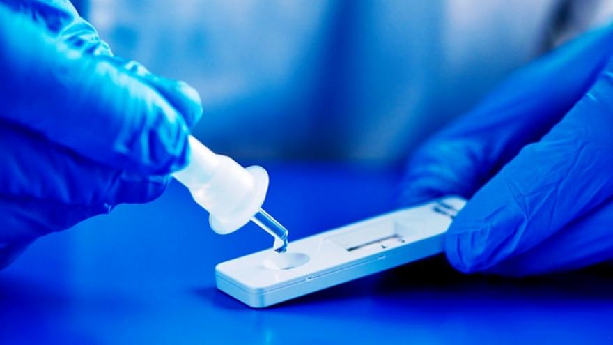 Νέο τεστ, εξίσου αξιόπιστο με PCR, δίνει αποτέλεσμα άμεσα ...