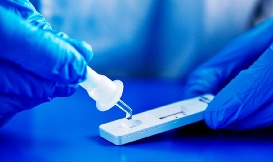 Κορωνοϊός: Ένα υποχρεωτικό rapid test την εβδομάδα - Επικαιρότητα ...